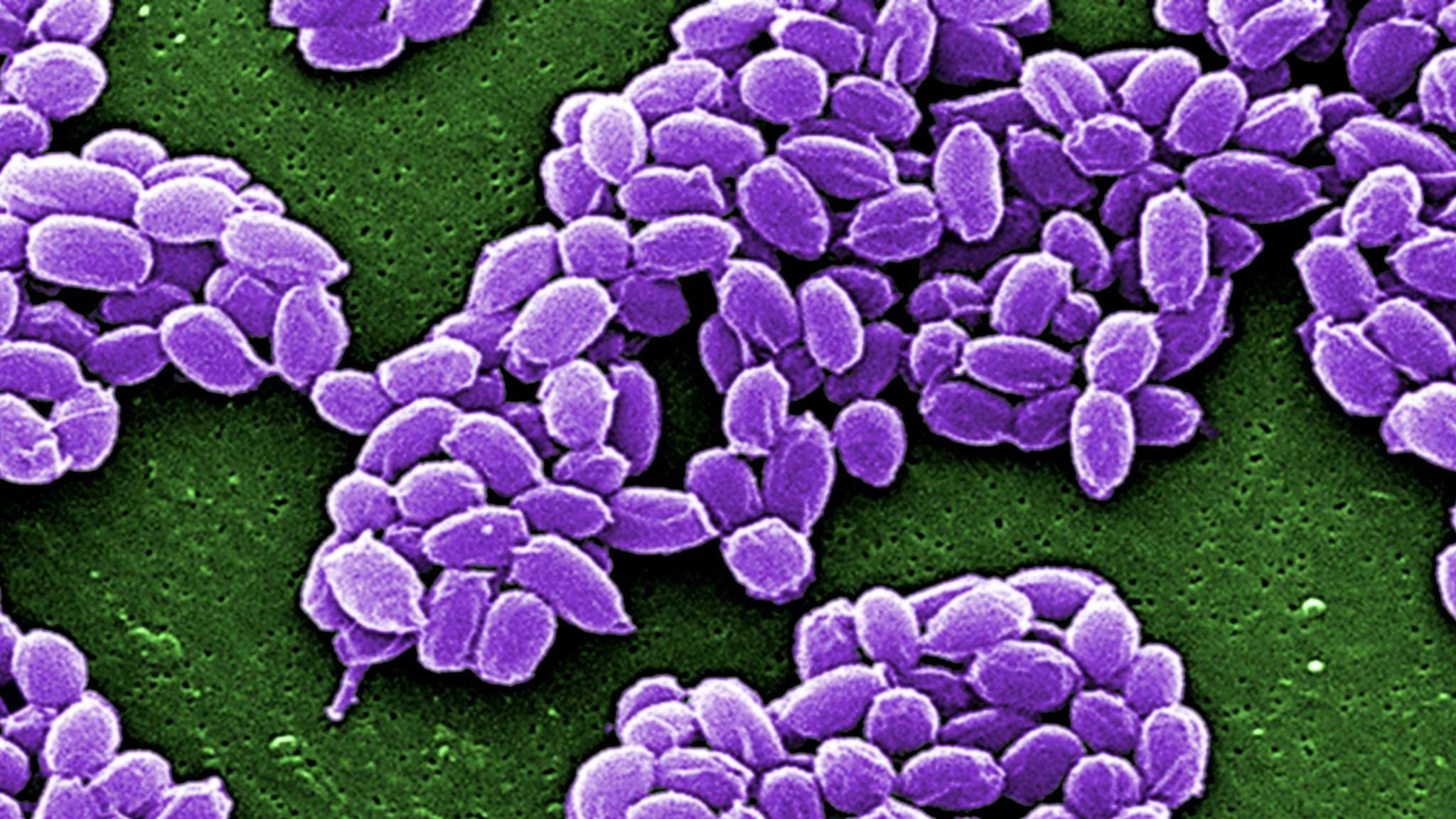 US Admits It Sent Lethal Anthrax To Australia | US News | Sky News