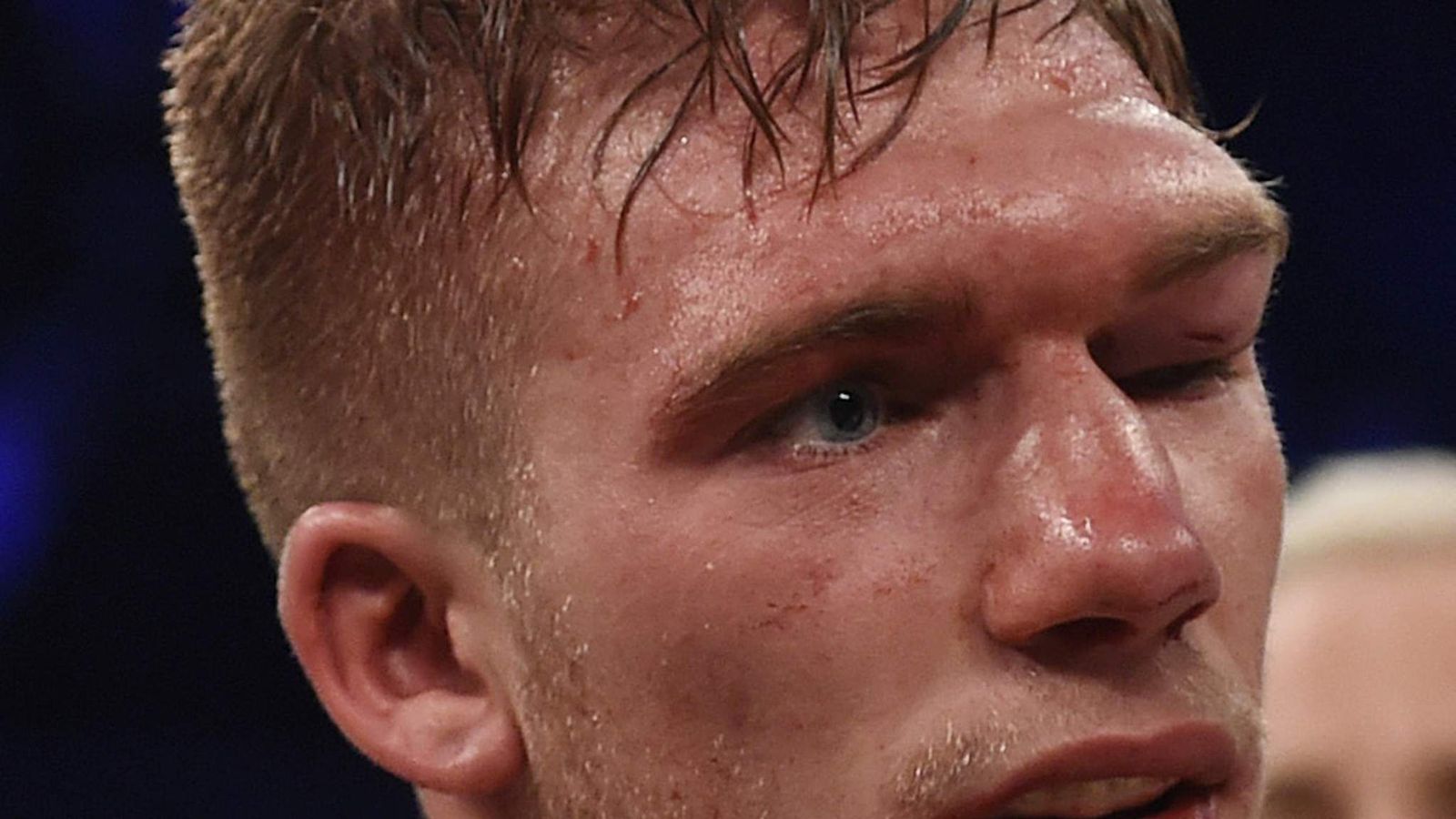 Boxer Blackwell In Coma After Eubank Fight | UK News | Sky News