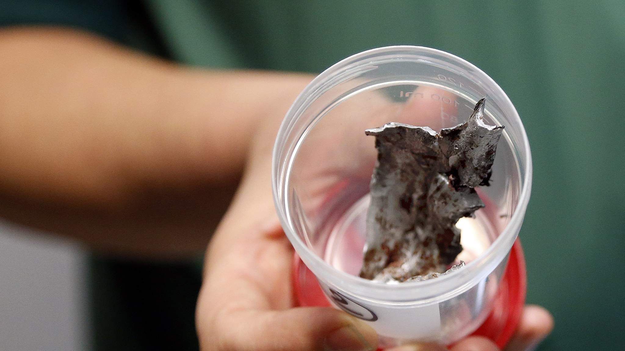 Doctors Reveal Shrapnel From Survivors' Bodies | World News | Sky News