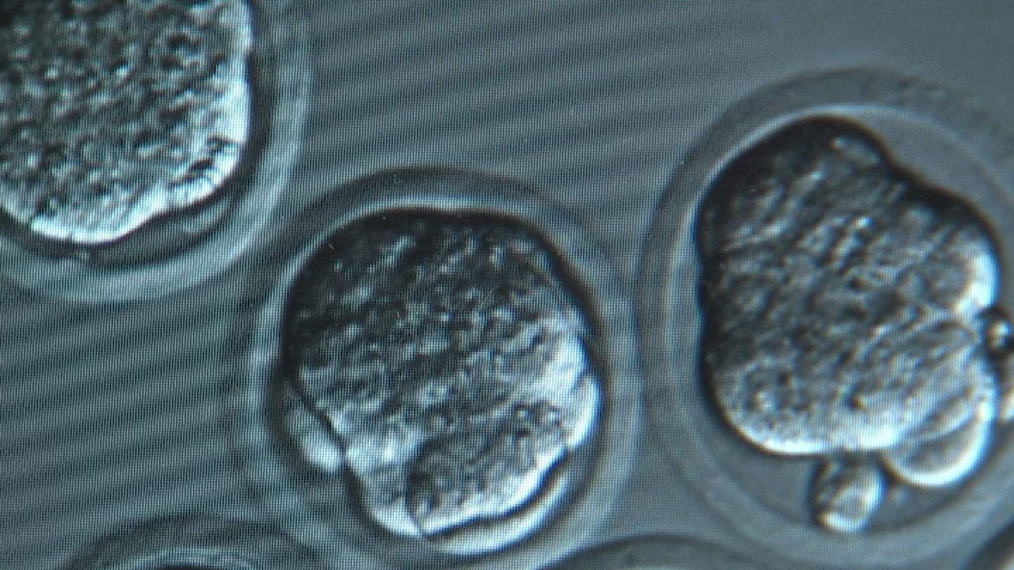 Fertility Clinic Sued For Allegedly Implanting Wrong Embryos World
