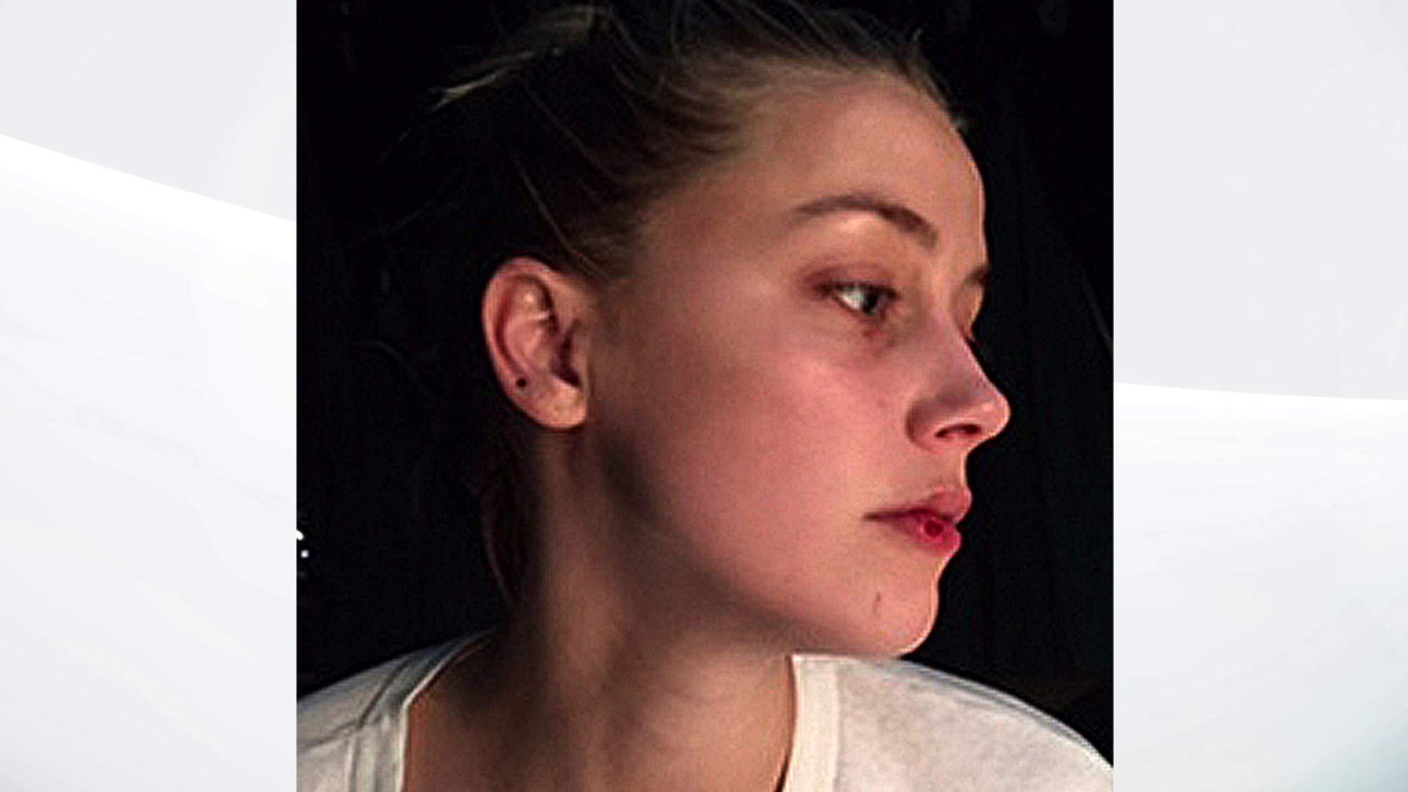 New Photos Show Heard After Depp 'Assault' | Ents & Arts News | Sky News