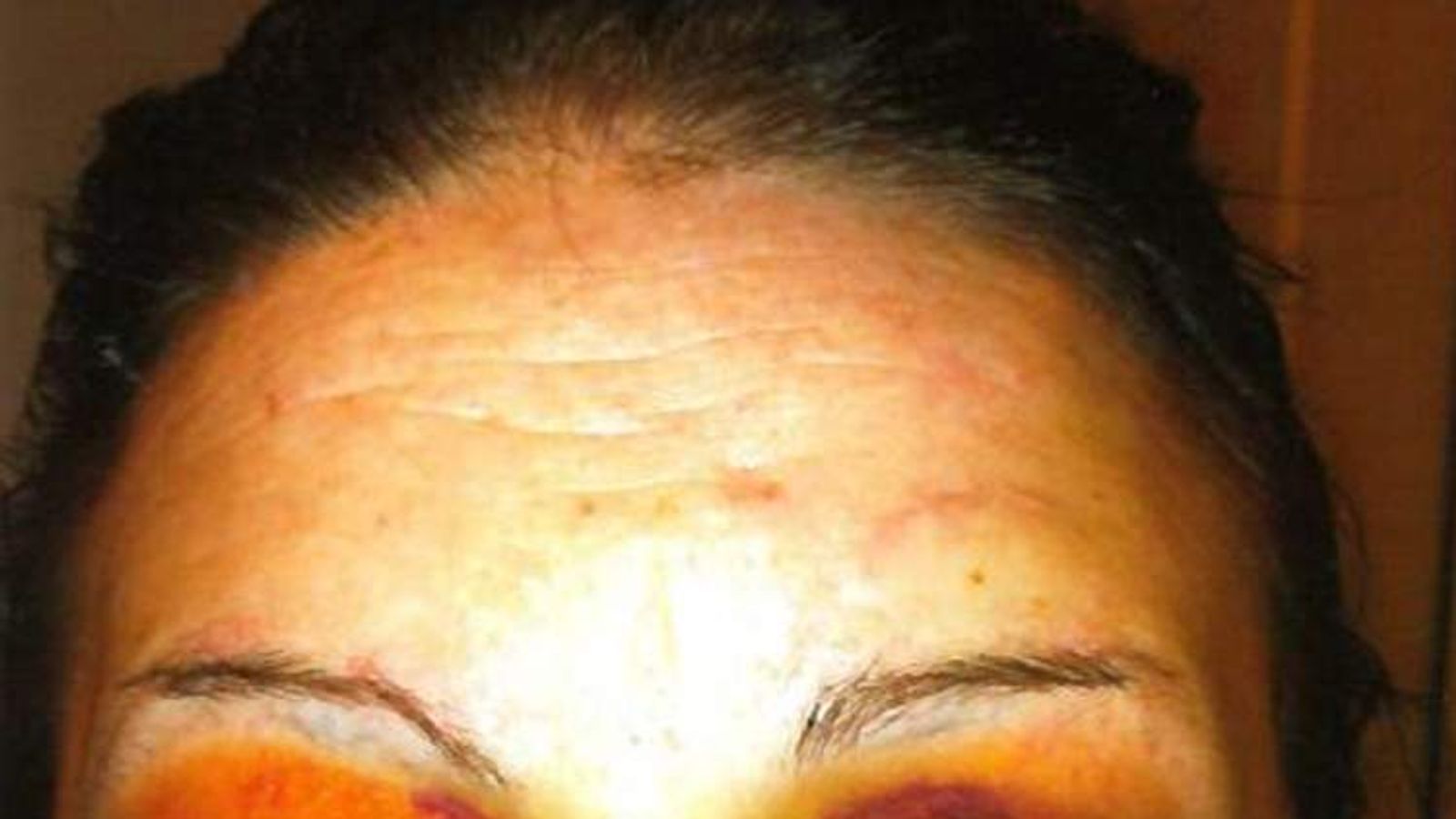 Domestic Abuse: Victim Shows Graphic Images | UK News | Sky News