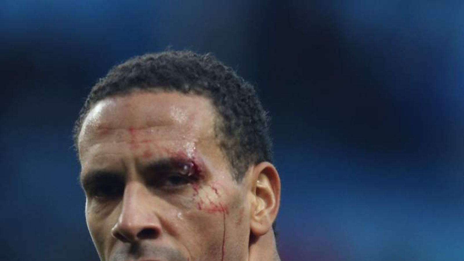 Rio Ferdinand: FA Inquiry As Star Hit By Coin | UK News | Sky News