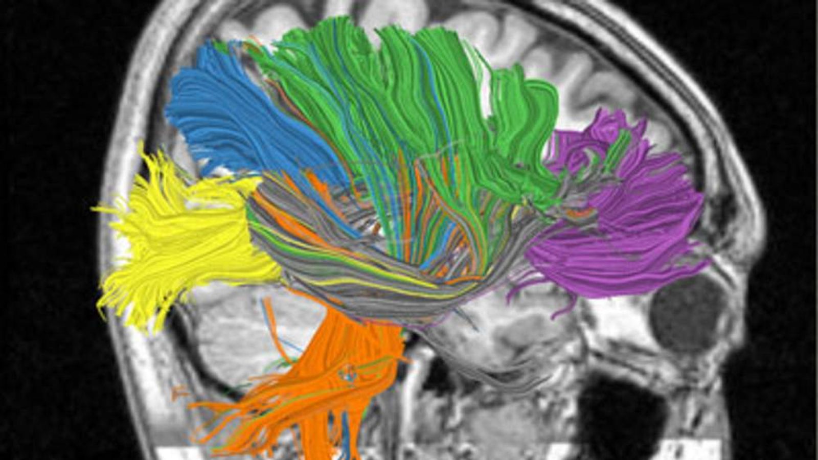 'Electronic Brain' Computer Chip Created | Science, Climate & Tech News ...