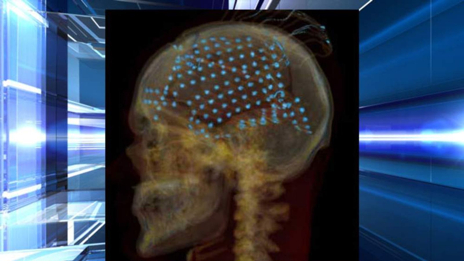 Computer Used To Decode Brain Activity | Science, Climate & Tech News ...