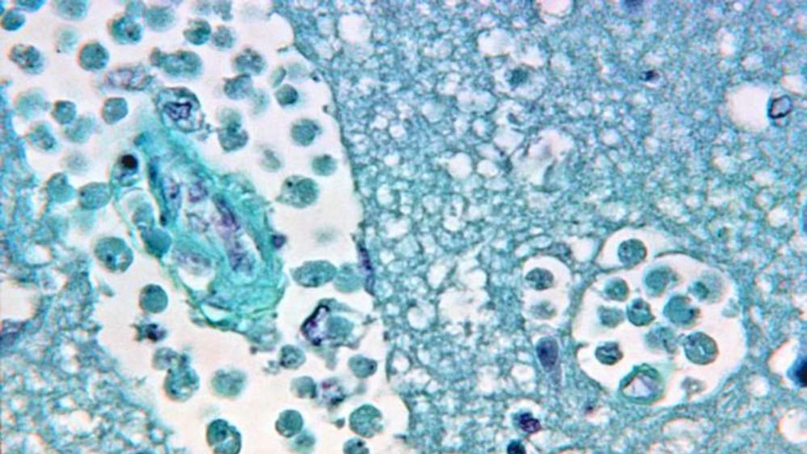 Brain-Eating Bug Enters US Water Supply | US News | Sky News