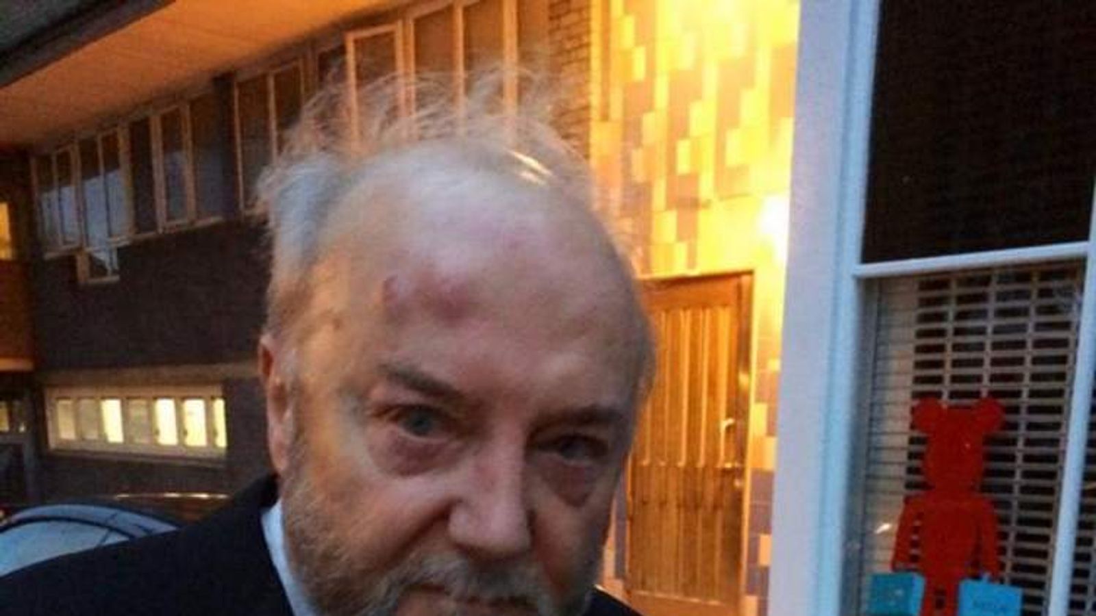 George Galloway's 'Jaw Broken' In Street Attack | UK News | Sky News