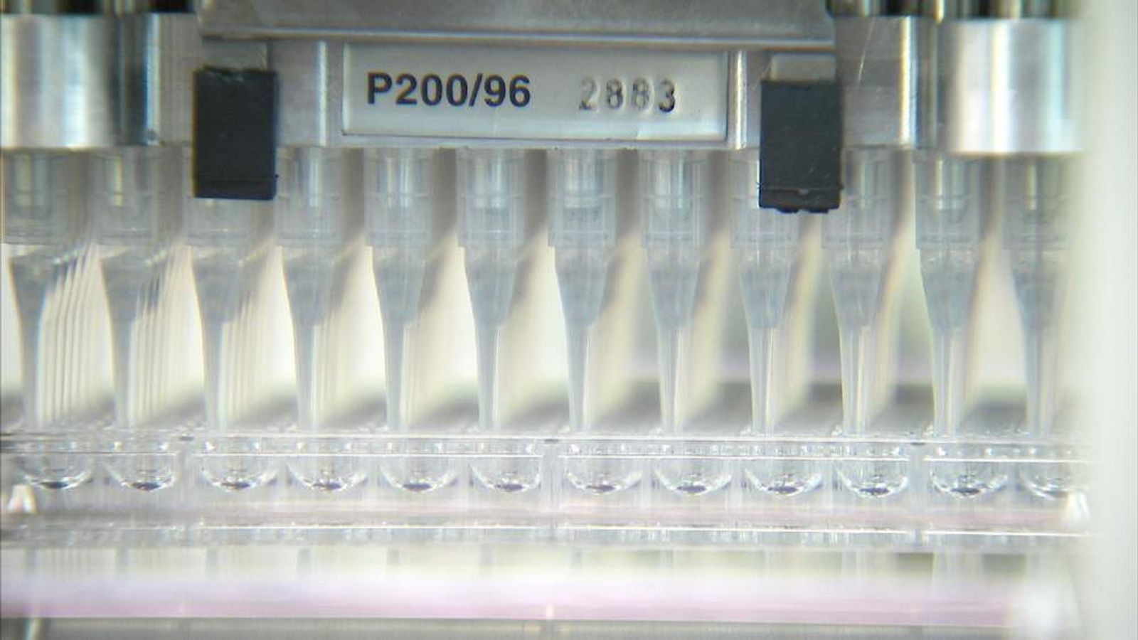 CJD: Call For Widespread Test To Detect Disease | UK News | Sky News