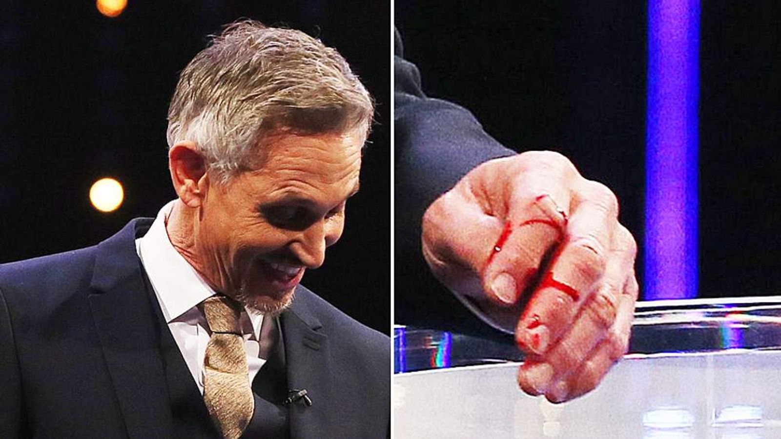Presenter Cuts His Hand On Sports Personality Of The Year Award | Scoop ...
