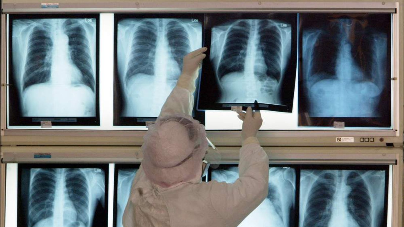 Biggest Cancer Killer Among Women Revealed | UK News | Sky News