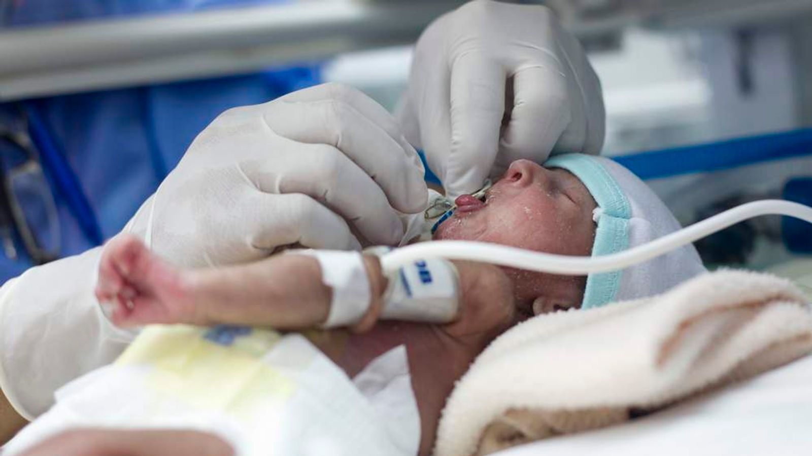 Premature Babies: Dilemma Over Care Grows | UK News | Sky News