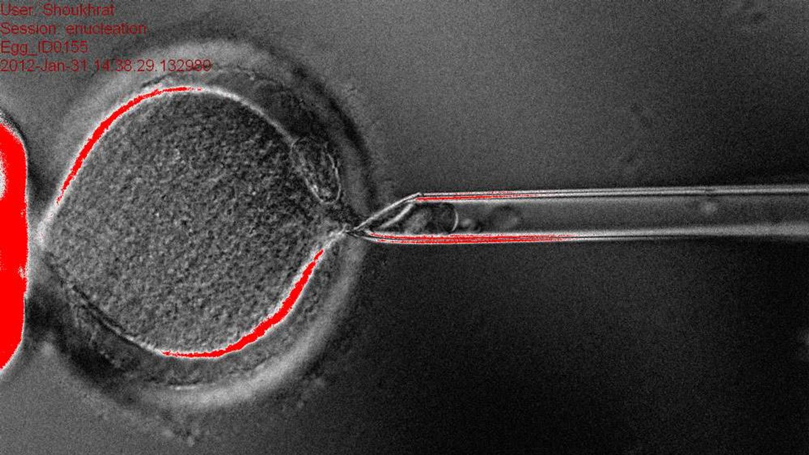 Stem Cells Made From Cloned Human Embryos | Science, Climate & Tech ...