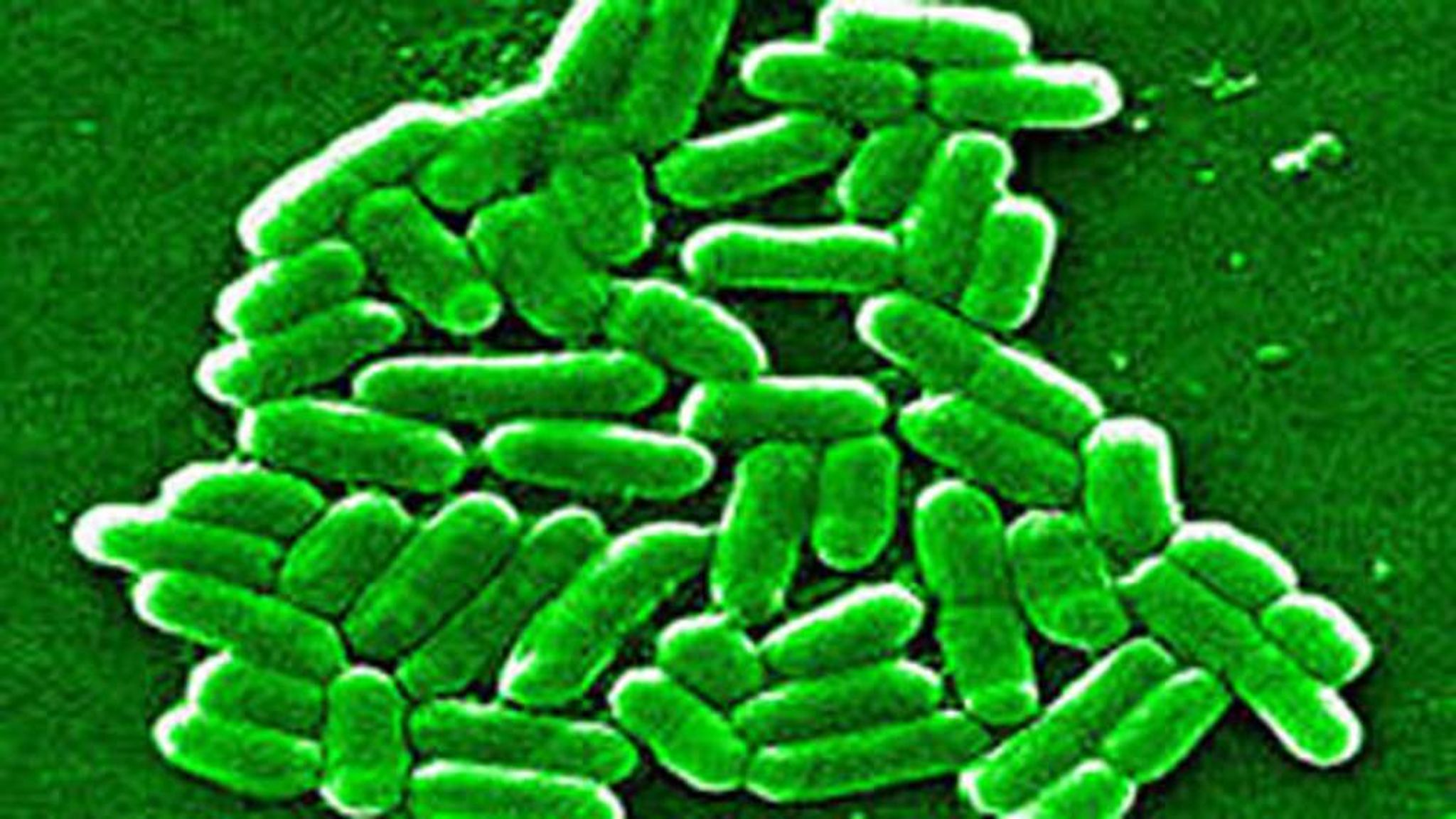 E.coli Victims Compensated For Farm Outbreak | UK News | Sky News