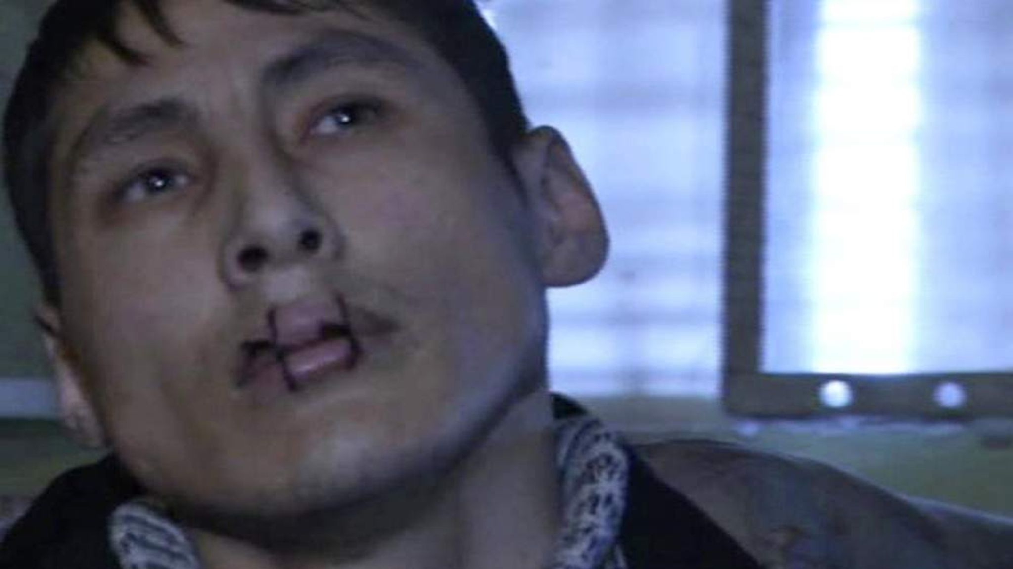 Prisoners Sew Lips Together In Hunger Strike | World News | Sky News