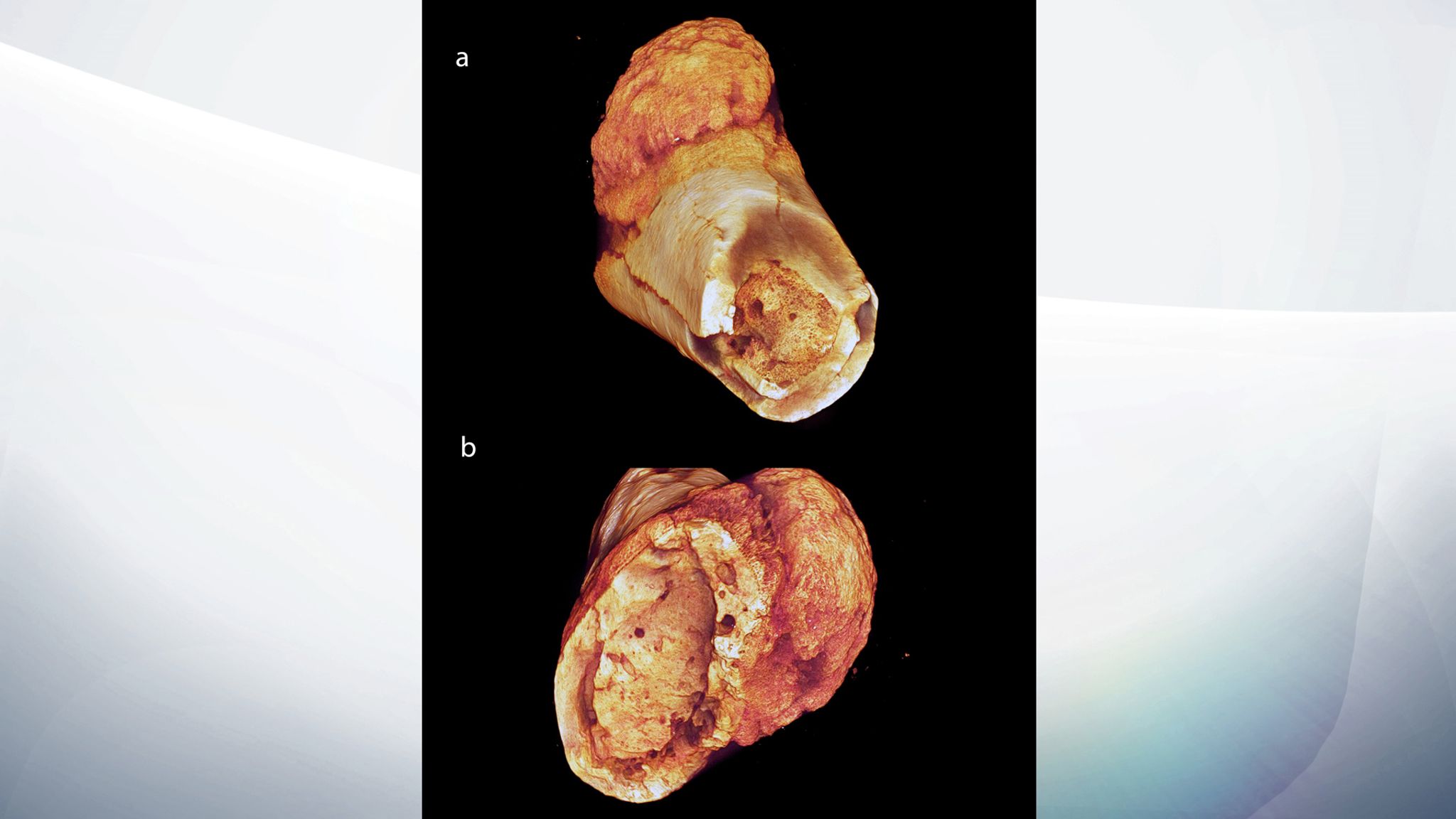 Oldest Cancer Found In 1.7 Million-Year-Old Bone | UK News | Sky News