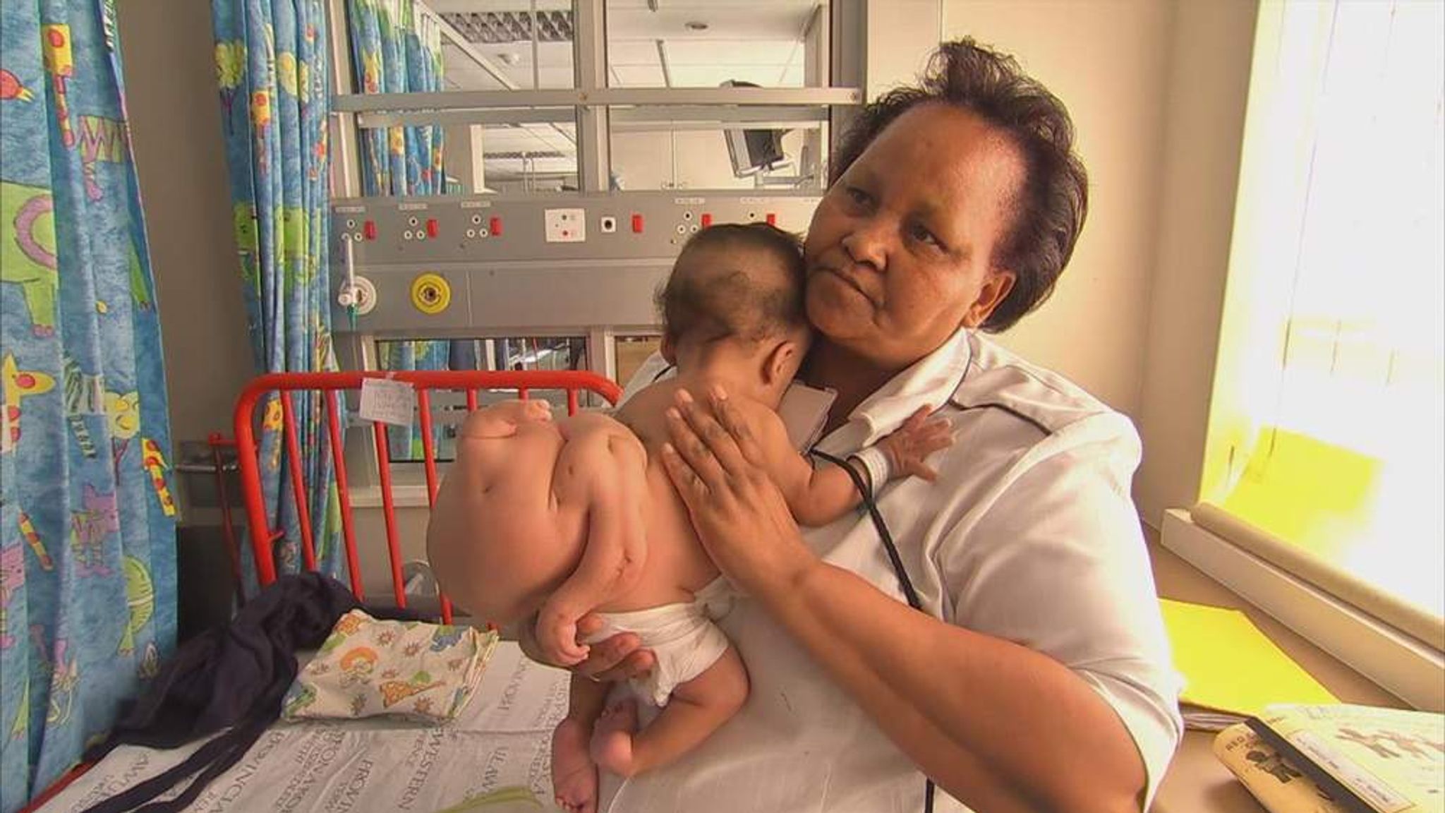 Conjoined Twin's Brave Fight For Survival | World News | Sky News