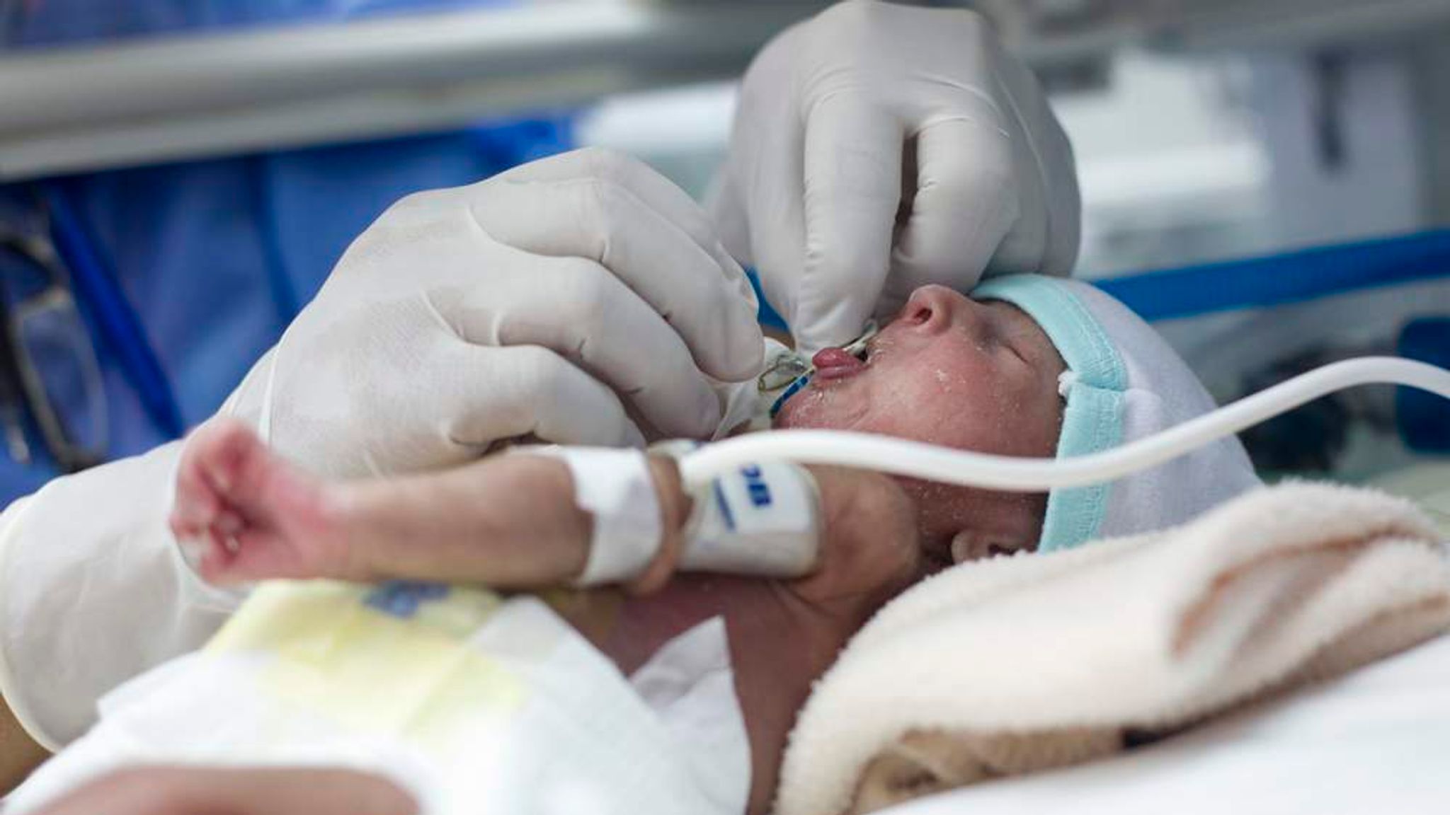 Inflatable Incubator Creator Wins Dyson Award | Science, Climate & Tech ...