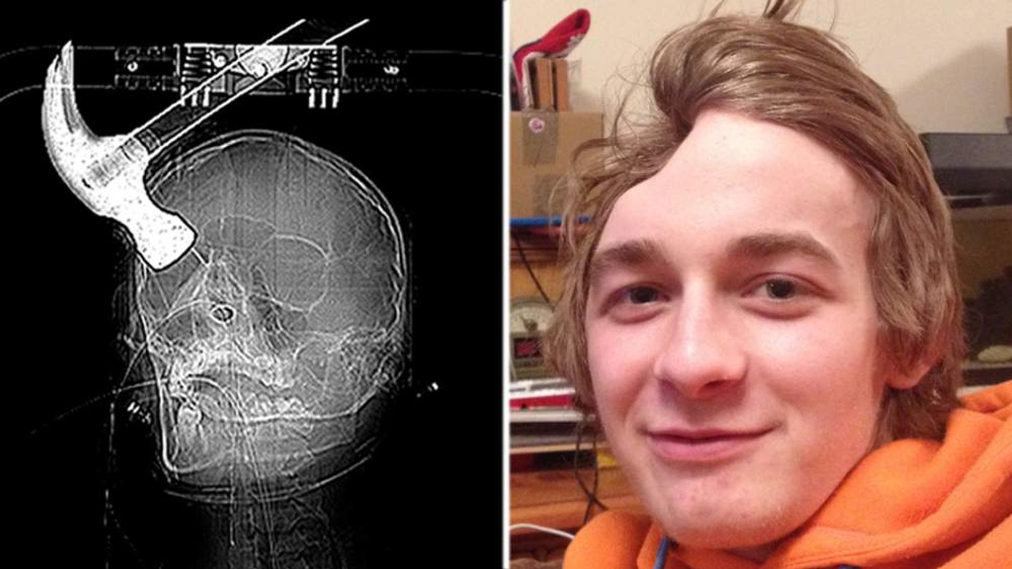 'Catastrophic' Hammer-Attack Injuries Revealed | UK News | Sky News