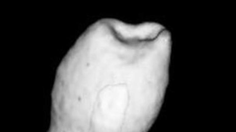 Tooth Grown From Human And Mouse Cells | UK News | Sky News