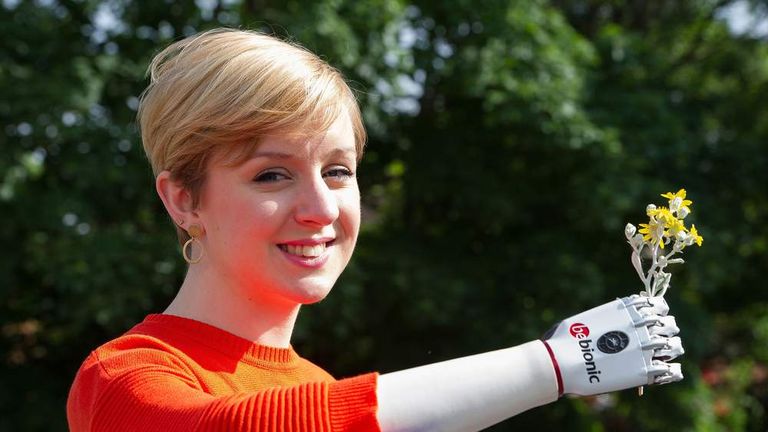 Woman Gets 'Most Life-Like Bionic Hand' | UK News | Sky News