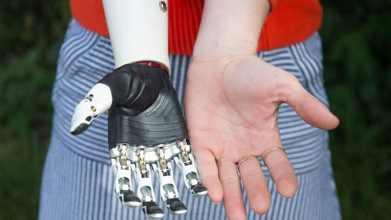 Woman Gets 'Most Life-Like Bionic Hand' | UK News | Sky News