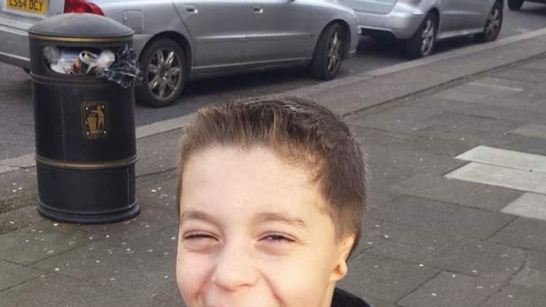 Boy With No Ears Gets Pair Made From His Ribs | UK News | Sky News