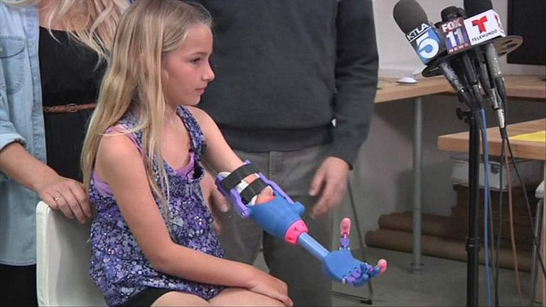 Revolutionary 3D Printed Hand Costs Just £30 | Scoop News | Sky News