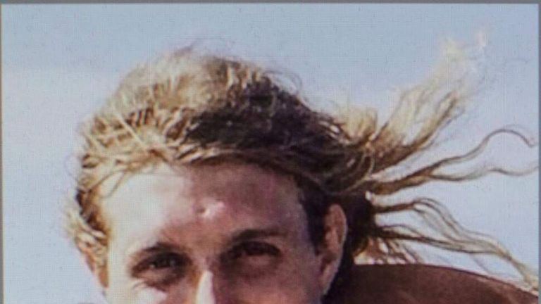 Firefighter Receives 'Historic' Face Transplant | US News | Sky News