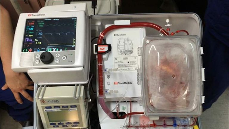 Oz Doctors In First 'Dead Heart' Transplant | World News | Sky News