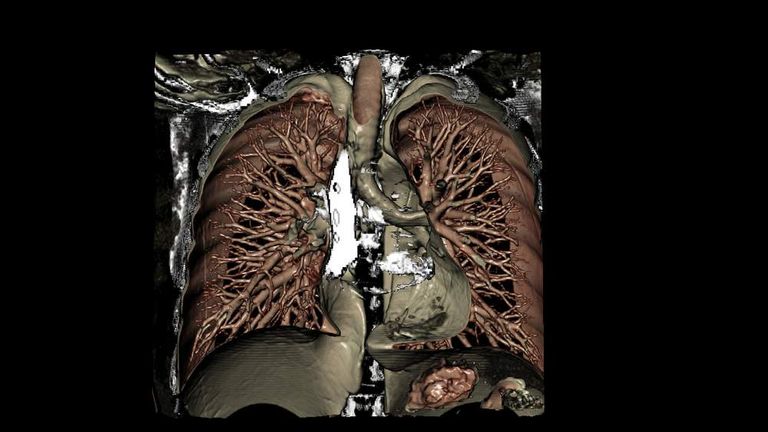 Digital Post-Mortem Centre To Open In UK | Science, Climate & Tech News ...