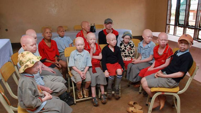 Albino Toddler Murdered For 'Lucky' Body Parts | World News | Sky News