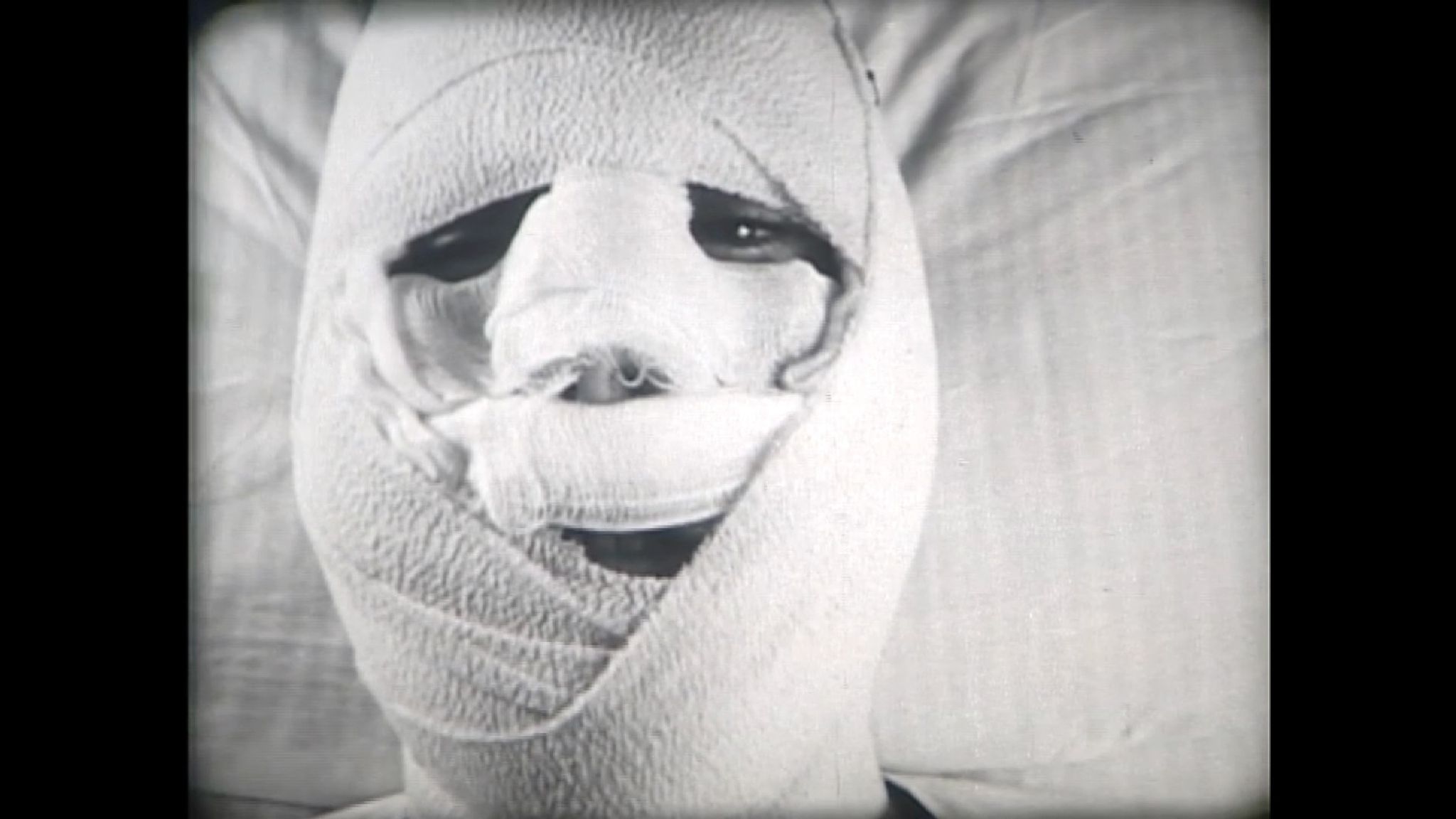 National monument to WW2 plastic surgery 'Guinea Pigs' | UK News | Sky News