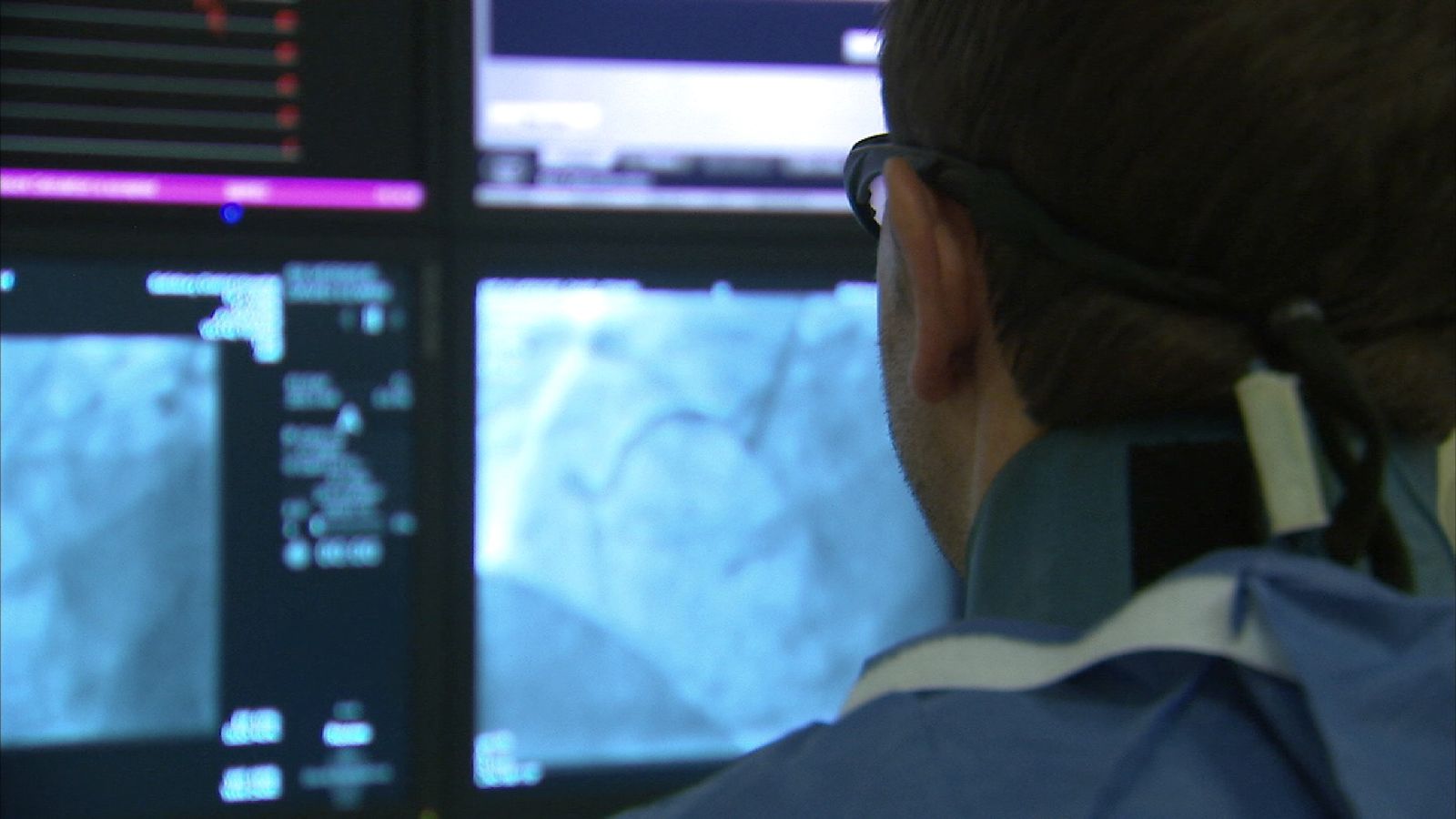 NHS trials barcode system to reduce mistakes during treatments | UK ...