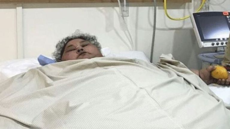 World's fattest woman leaves house after two decades for stomach op ...