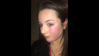 Emily Drouet's parents criticise university over daughter's suicide ...