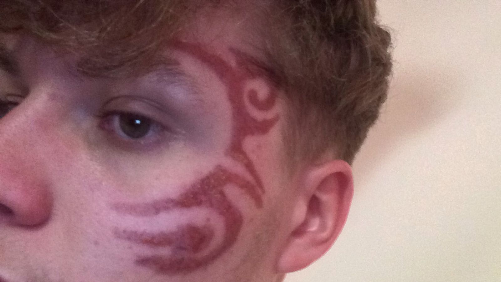 Pain and scarring: Warning over chemical filled black henna tattoos ...