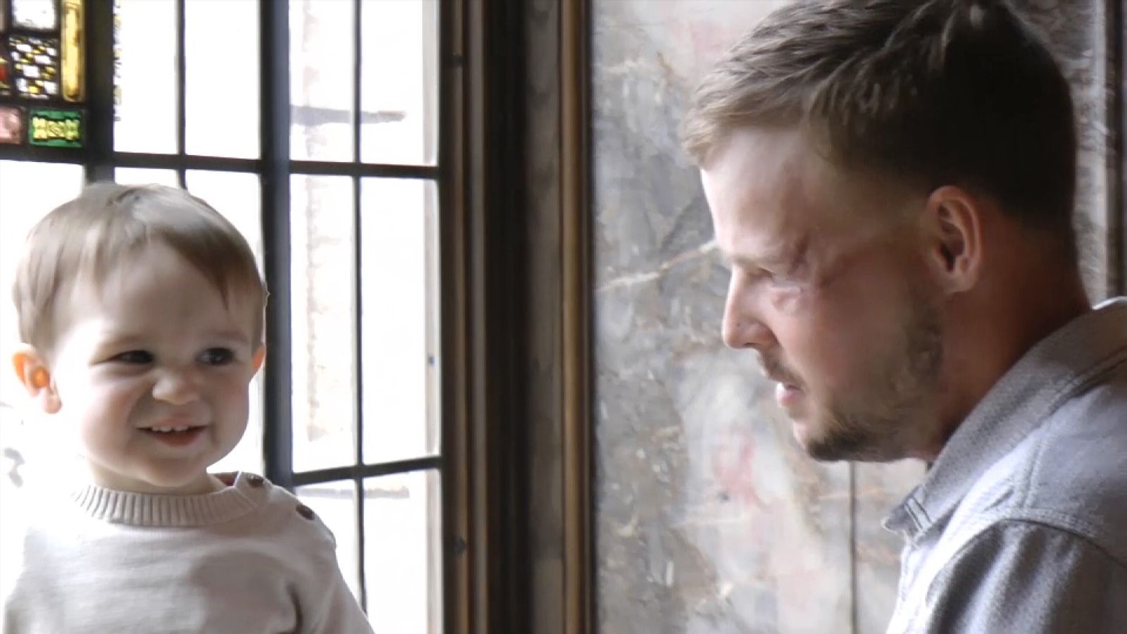 Widow meets man given her dead husband's face in transplant | World ...