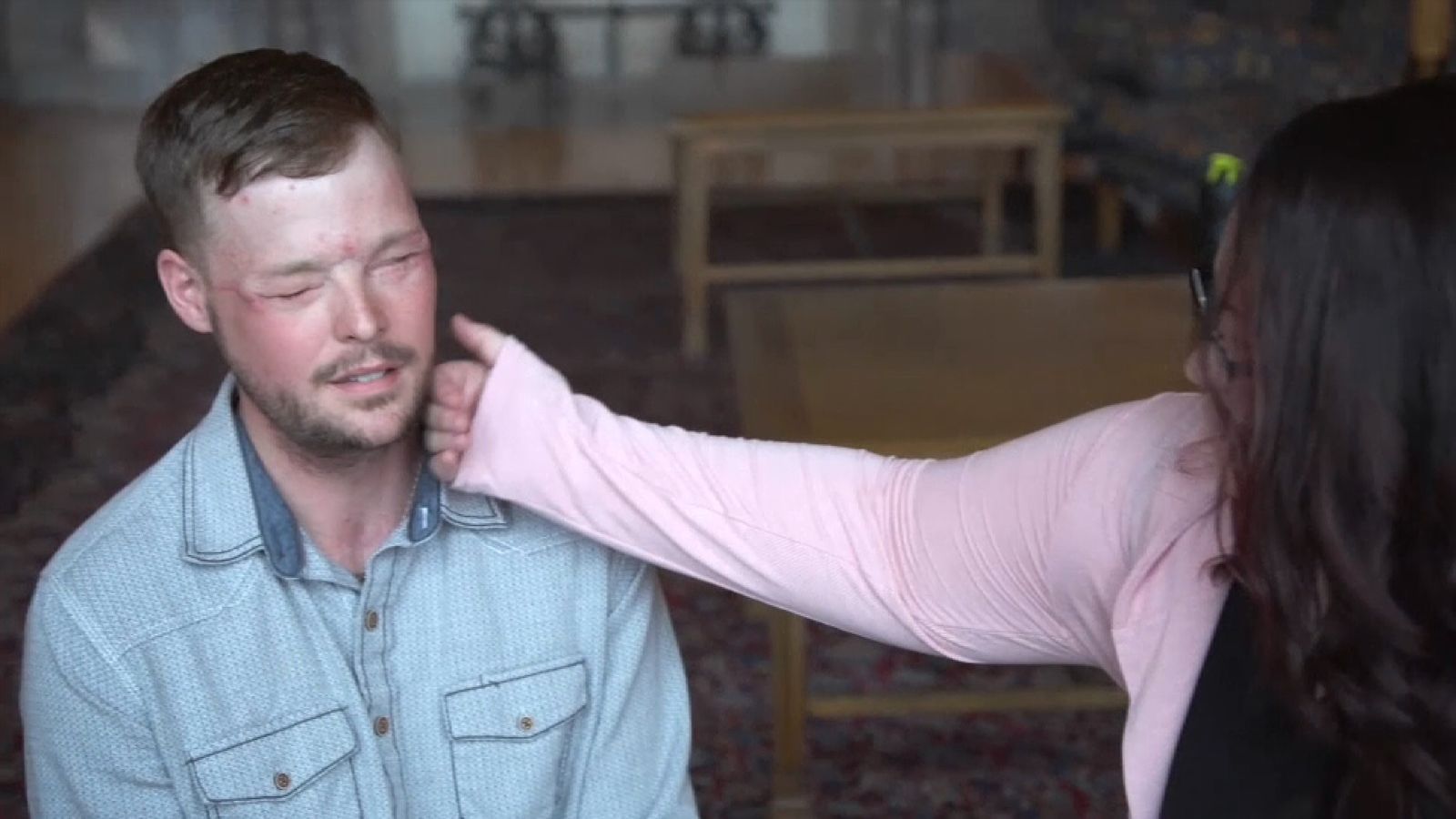 Face transplant man meets widow | News UK Video News | Sky News