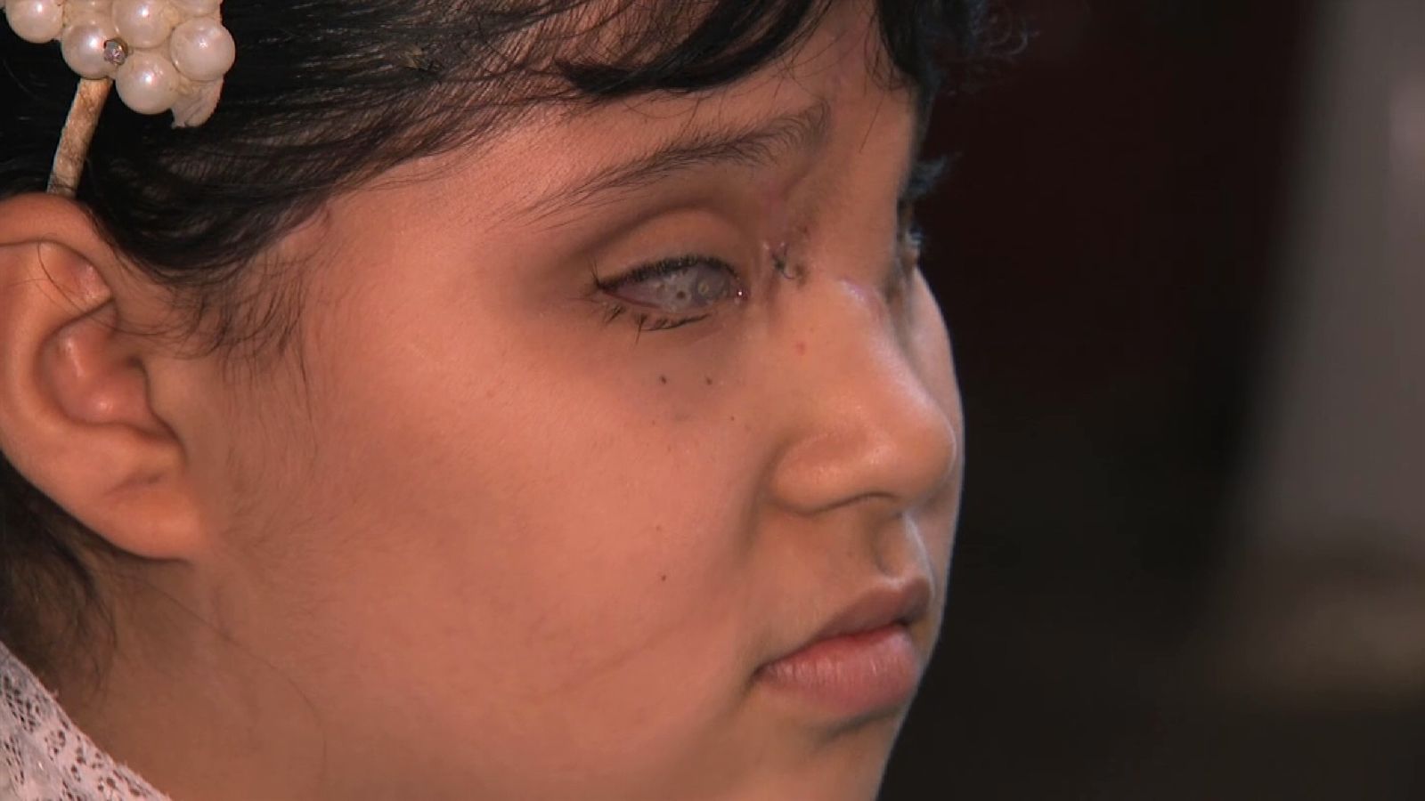 Victim of sniper's bullet dreams of normal life | News UK Video News ...