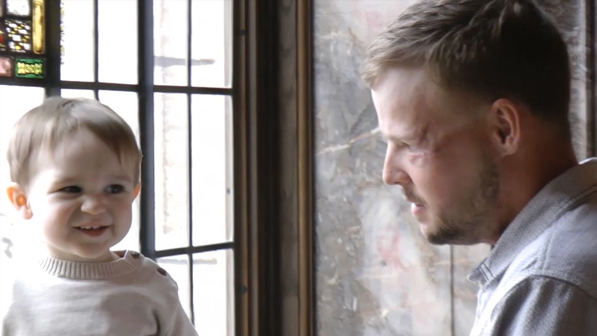 Widow meets man given her dead husband's face in transplant | World ...