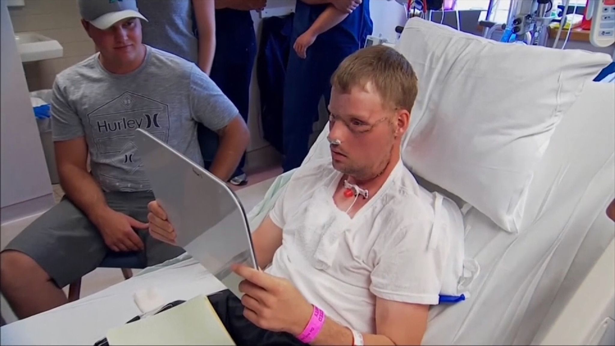 Widow meets man given her dead husband's face in transplant | World ...