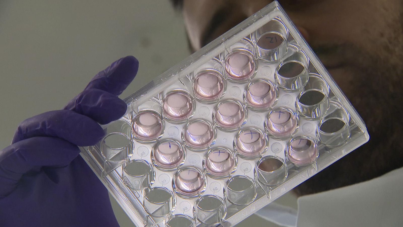 Mini tumours grown in lab are breakthrough for medicine tests | Science ...