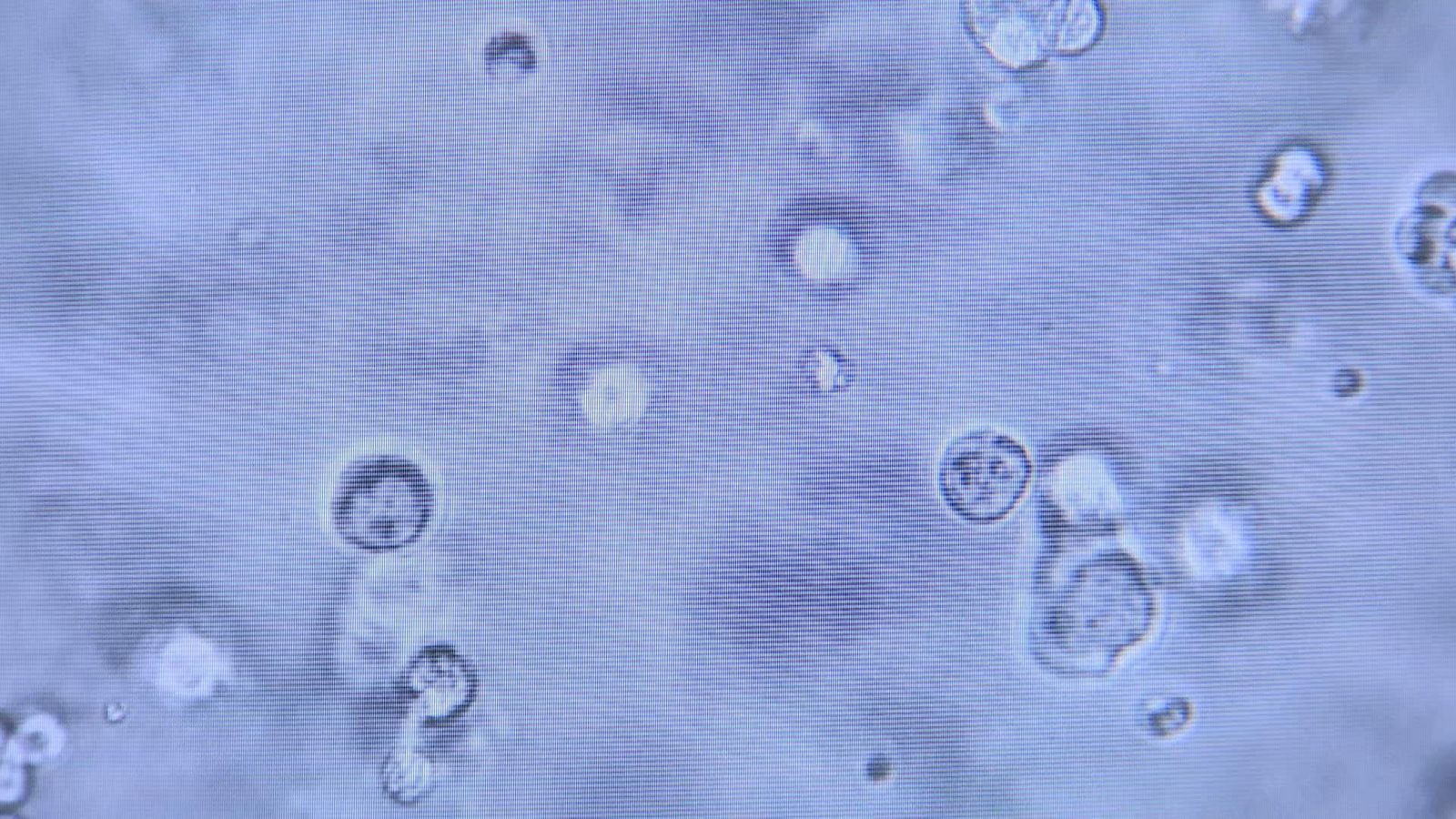 Mini tumours grown in lab are breakthrough for medicine tests | Science ...