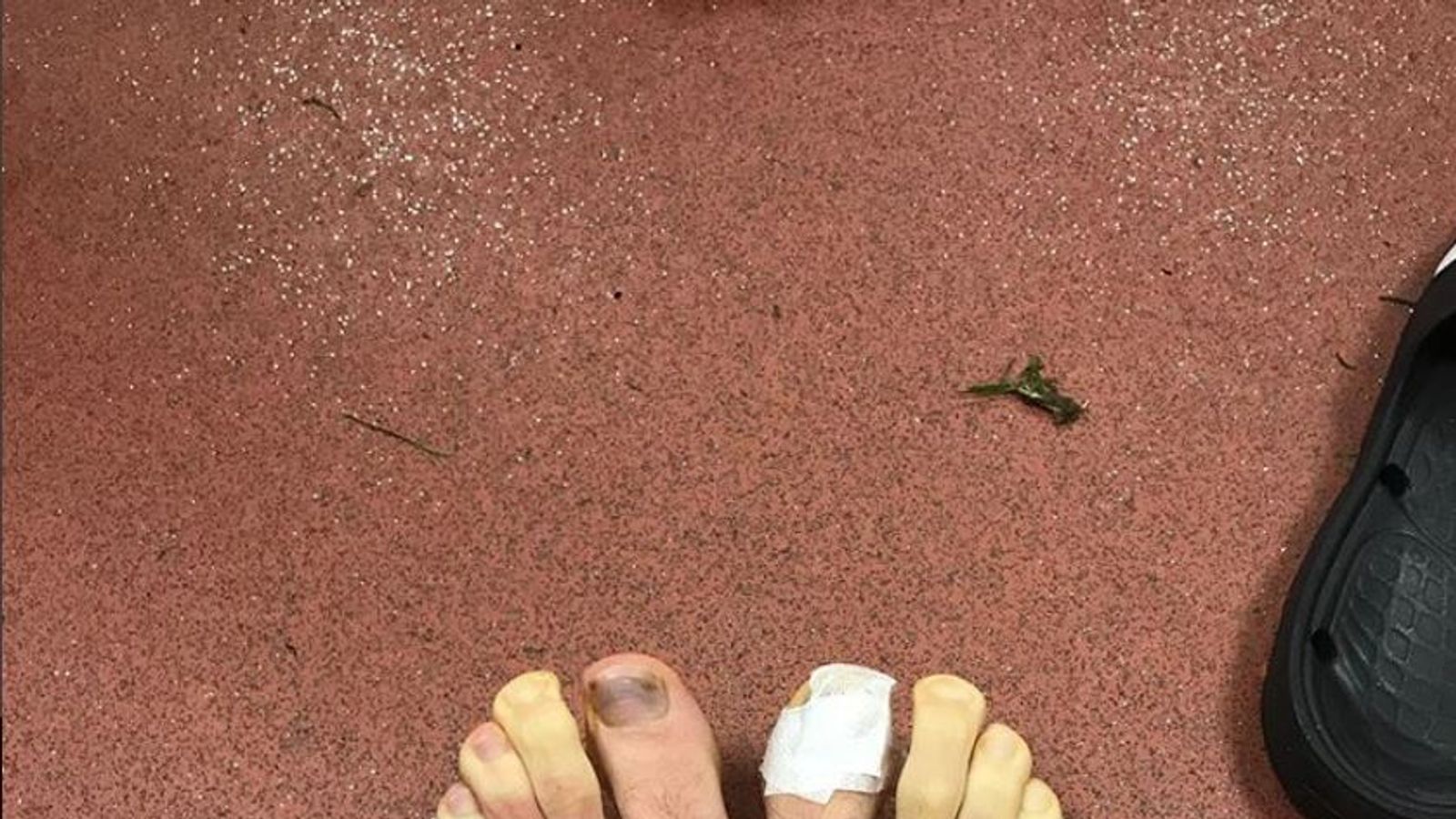 Liverpool star Adam Lallana's toes turn yellow after match on freezing ...