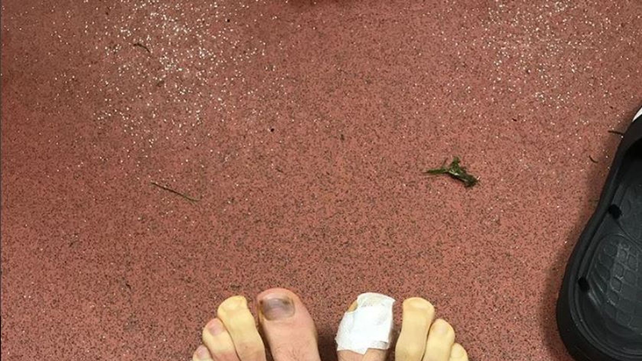 Liverpool star Adam Lallana's toes turn yellow after match on freezing ...