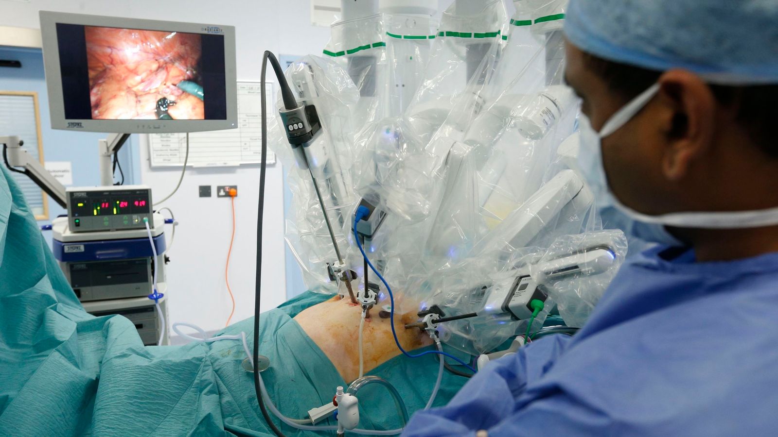 Robot performs double surgery on cancer patient in rare procedure ...