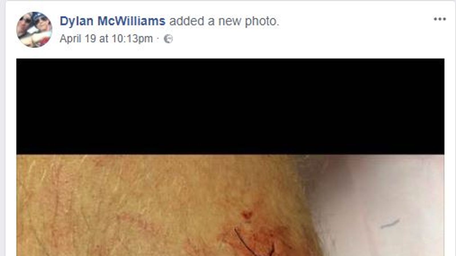 Man bitten by shark previously mauled by bear and bitten by a snake ...