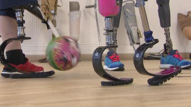 Hundreds of children to get 'activity' prosthetics in new Government ...