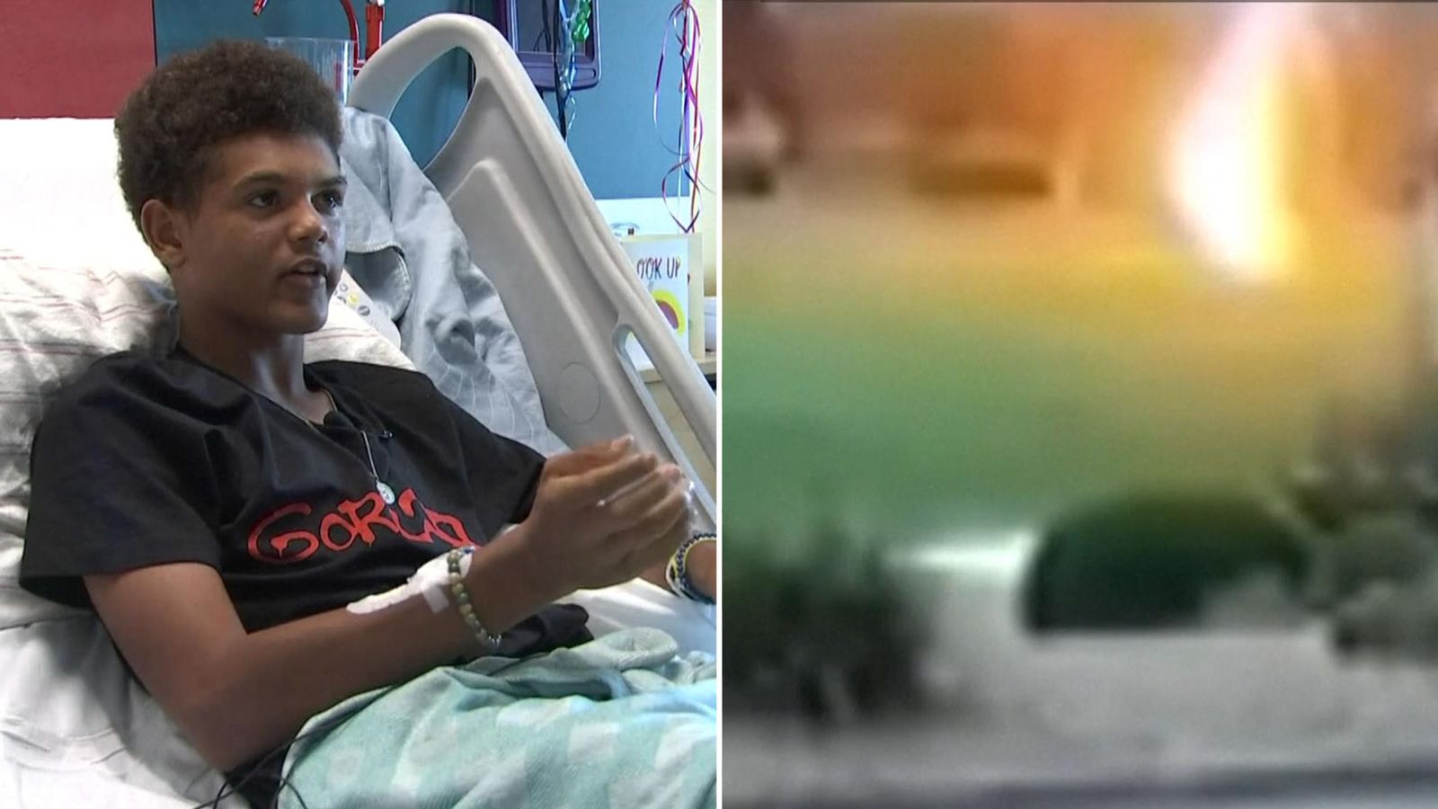 Teen 'feels like Superman' after surviving lightning strike | US News ...