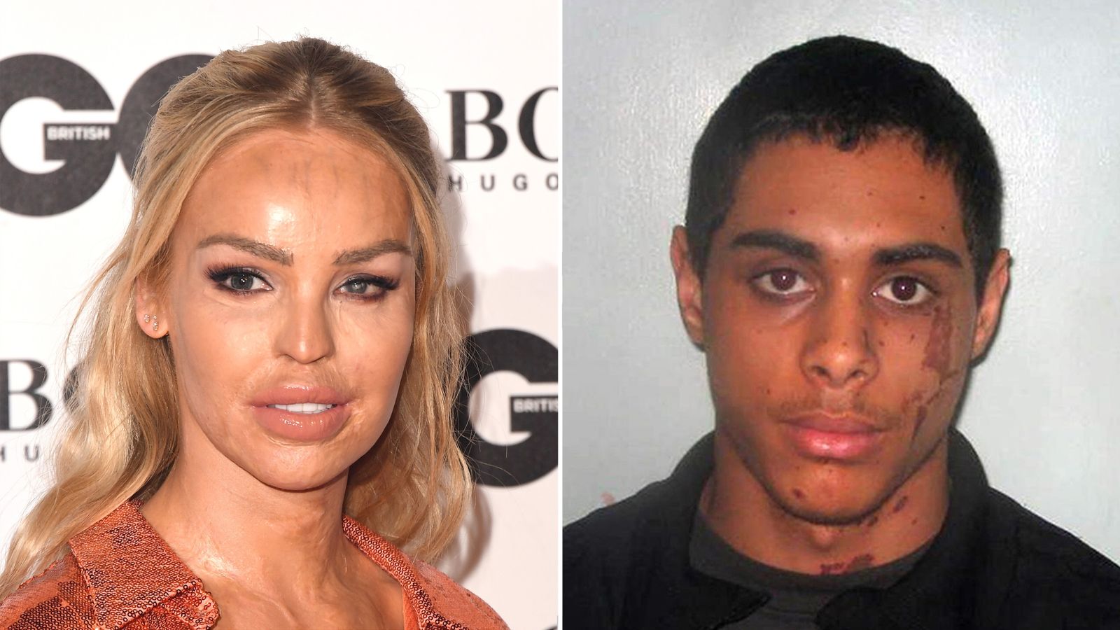 Police Hunting Man Who Threw Acid Over TV Presenter Katie Piper UK Police Hunting Man Who Threw Acid Over TV Presenter Katie Piper UK